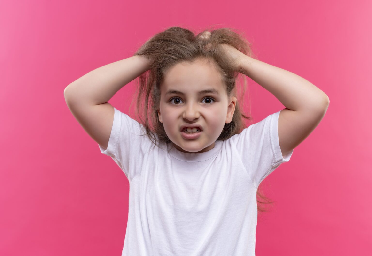 Children with Hairloss Causes and Treatment