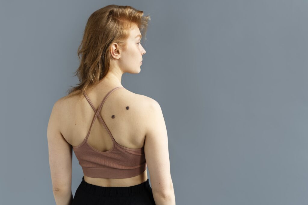 What Causes Sideburns Women Situation?